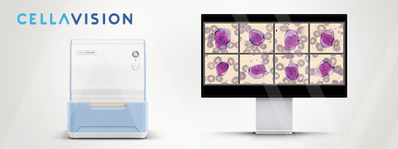 Monthly Cell Challenge #1 | CellaVision